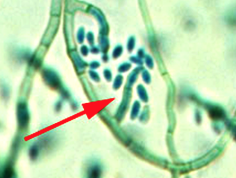 Mycology Flashcards by Claire Chiz