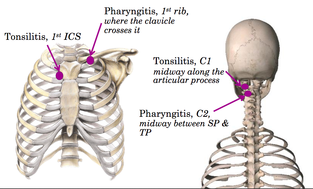 Lecture 2: Viscerosomatic, Somatovisceral, Viscerovisceral and ...