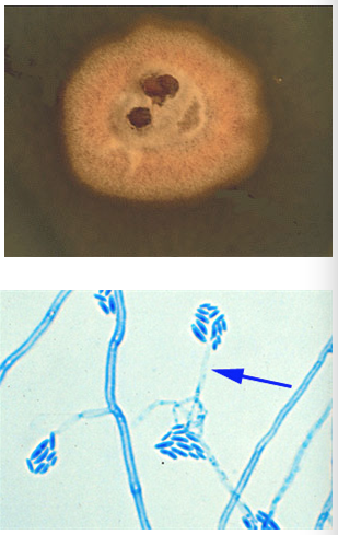 Mycology Flashcards by Claire Chiz | Brainscape