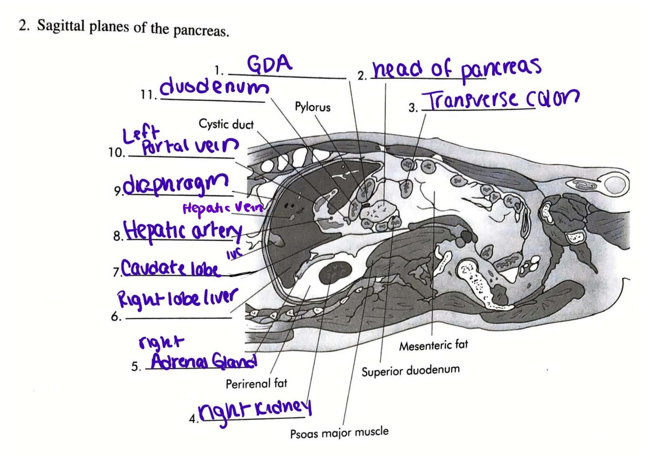 Funny Pancreas Drawing