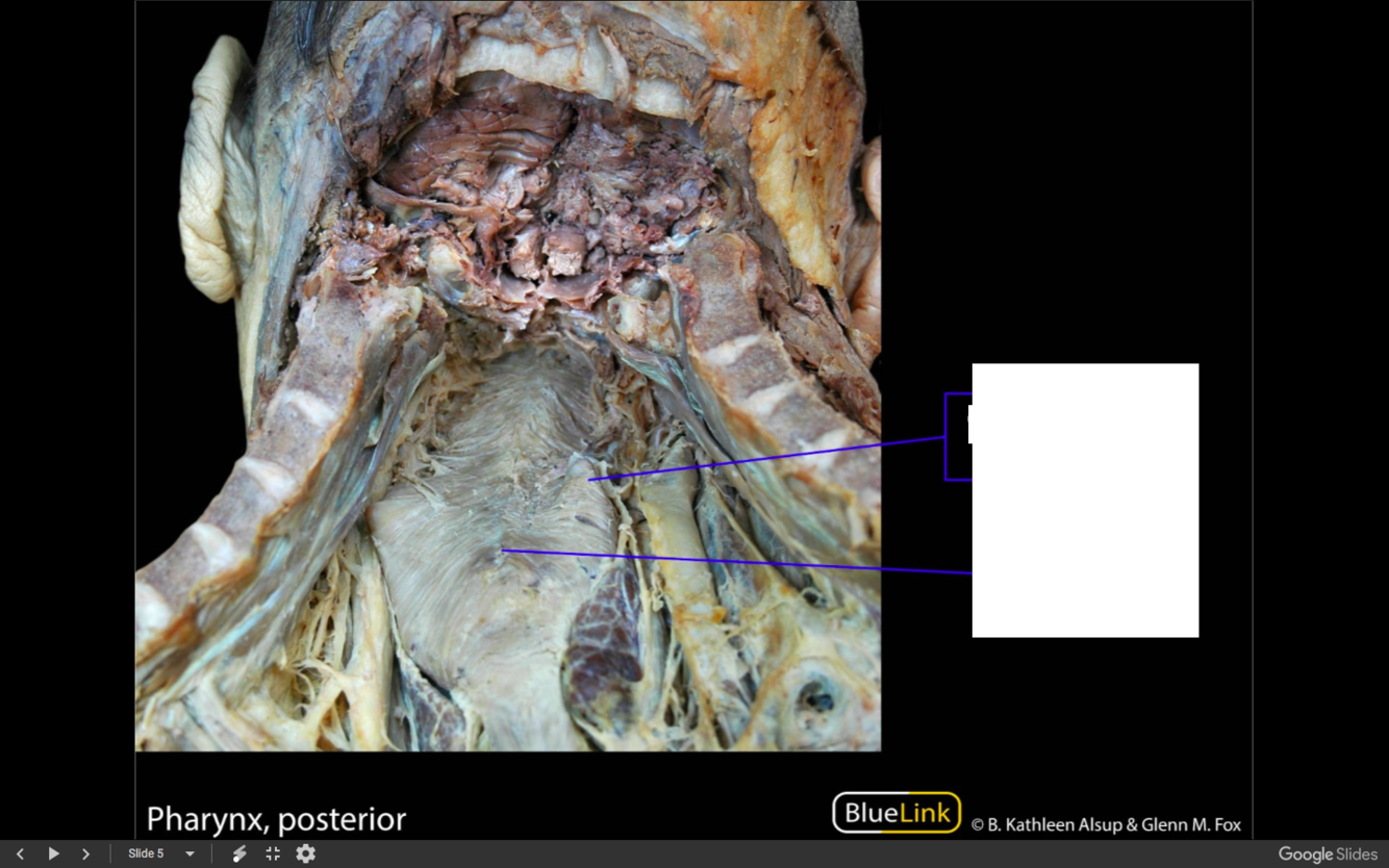 Pharynx Anatomy Cadaver