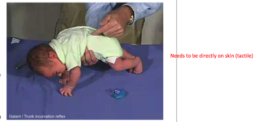 Trunk Incurvation Reflex