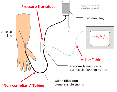 Arterial Line Pressure Bag