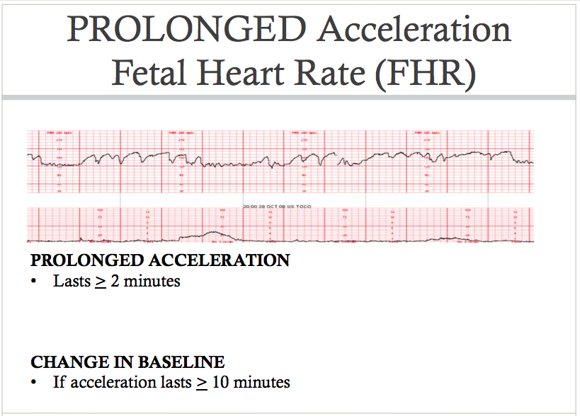 Accelerations Fhr