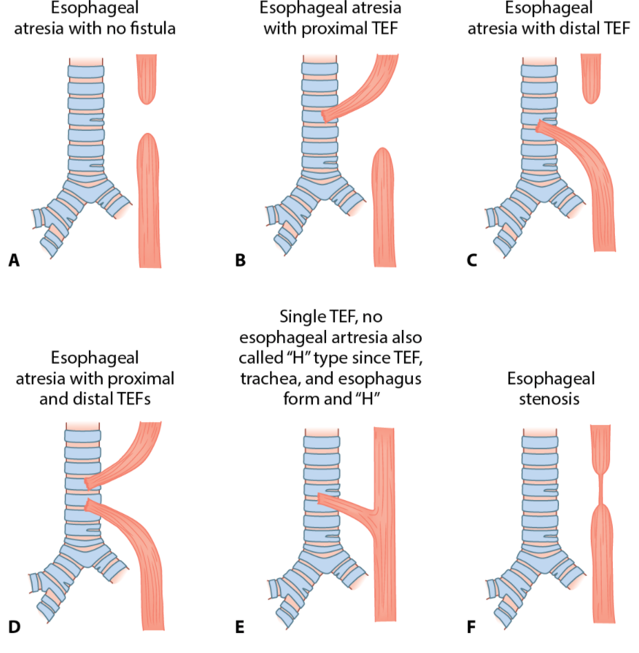 Proximal Vs Distal Esophagus
