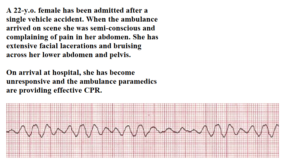 ALS and BLS Practice Questions Flashcards by Grace Yeung