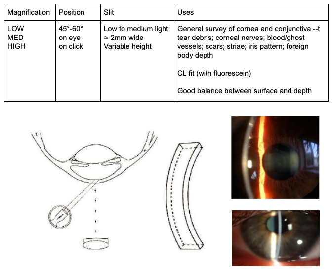 Slit Lamp Illuminations and 6-Month Follow-Up Flashcards by Gwyneth ...