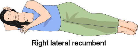 Positions for NCLEX-RN (1) Fundamentals