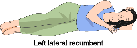 Positions for Nursing Fundamentals