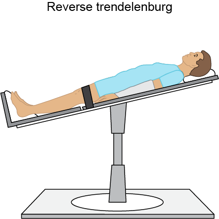 Trendelenburg Position For Air Embolism