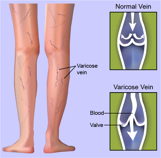 Positions for Nursing Fundamentals | Brainscape