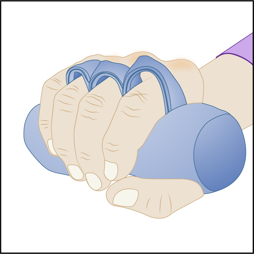 Positions for NCLEX-RN (1) Fundamentals | Brainscape