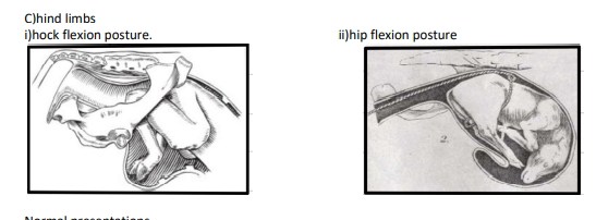 40. Definition of the presentation, position, and posture of the foetus ...