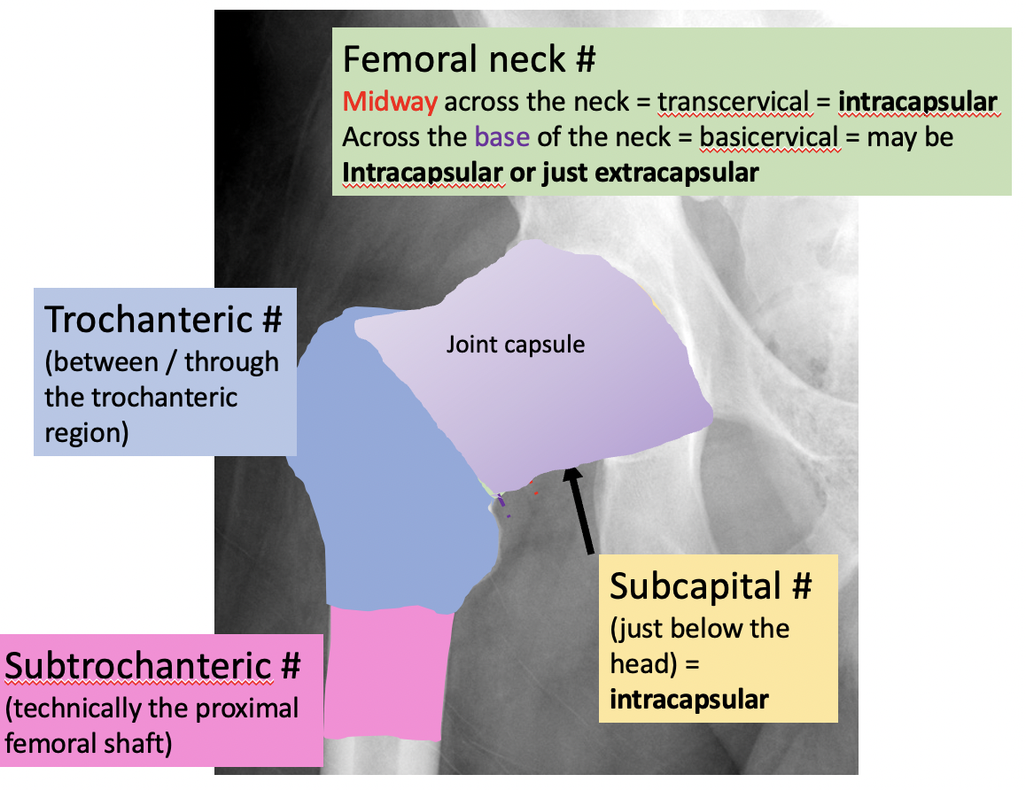 Imaging the Lower Limb Flashcards by Charlotte Tebbutt | Brainscape