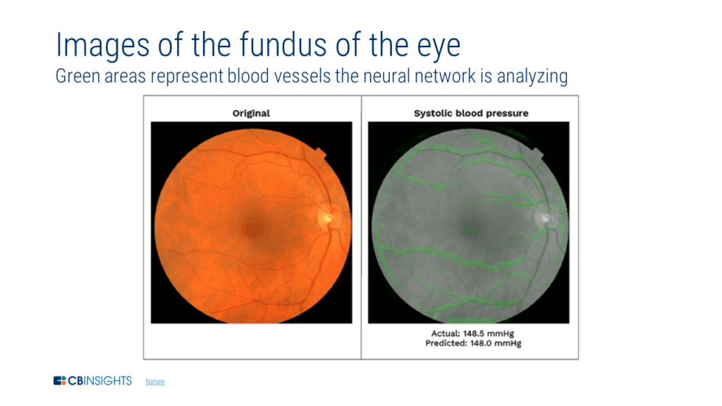 The Body Series: Disrupting Eye Healthcare - CB Insights Research