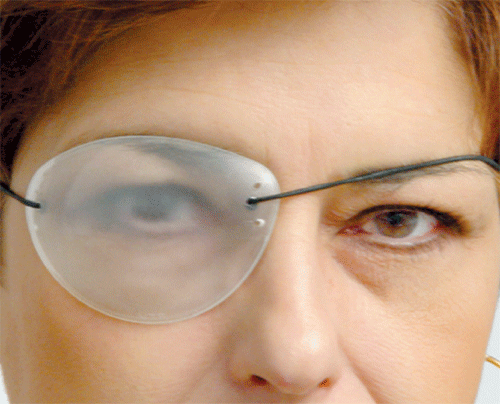 Translucent Eye Patch (VTE), Bangerter/Occlusion Patches: Bernell ...
