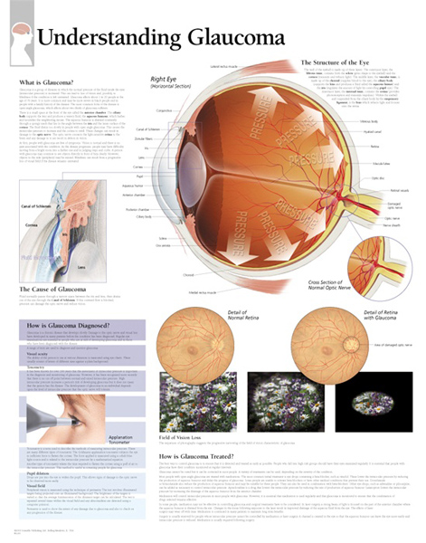 Glaucoma Poster, : Bernell Corporation
