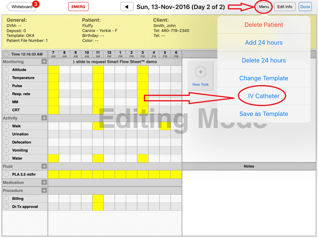 How do I delete an IV catheter? : Smart Flow Support