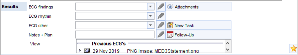 ECG : Ardens SystmOne