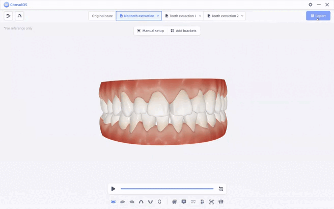 Ortho Simulation 3.0 : Dental Support