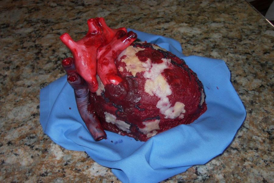 Human Heart - CakeCentral.com