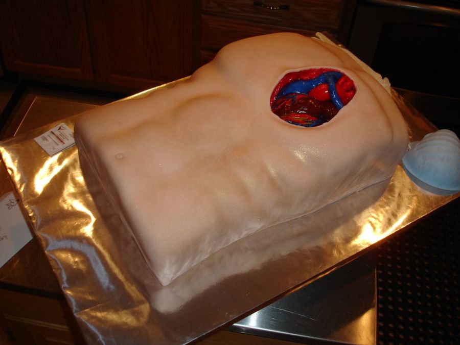 Open Heart Surgery - CakeCentral.com