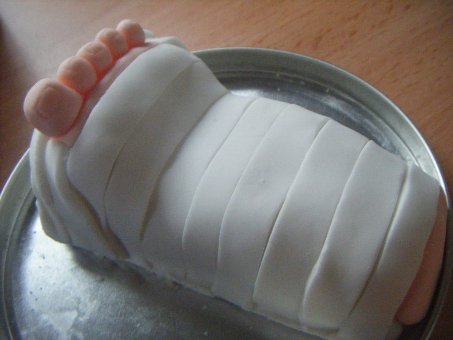 Broken Leg Cast - CakeCentral.com