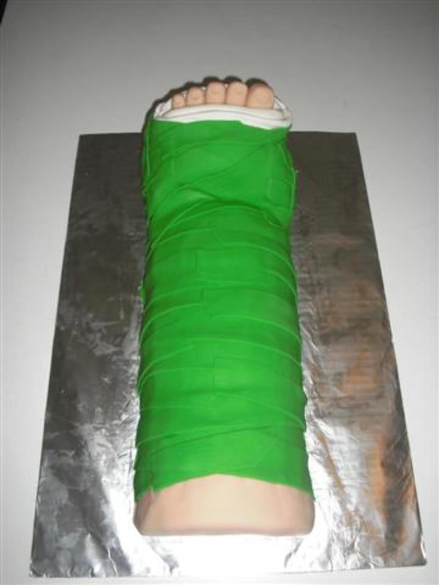 Broken Leg Cast Cake - CakeCentral.com