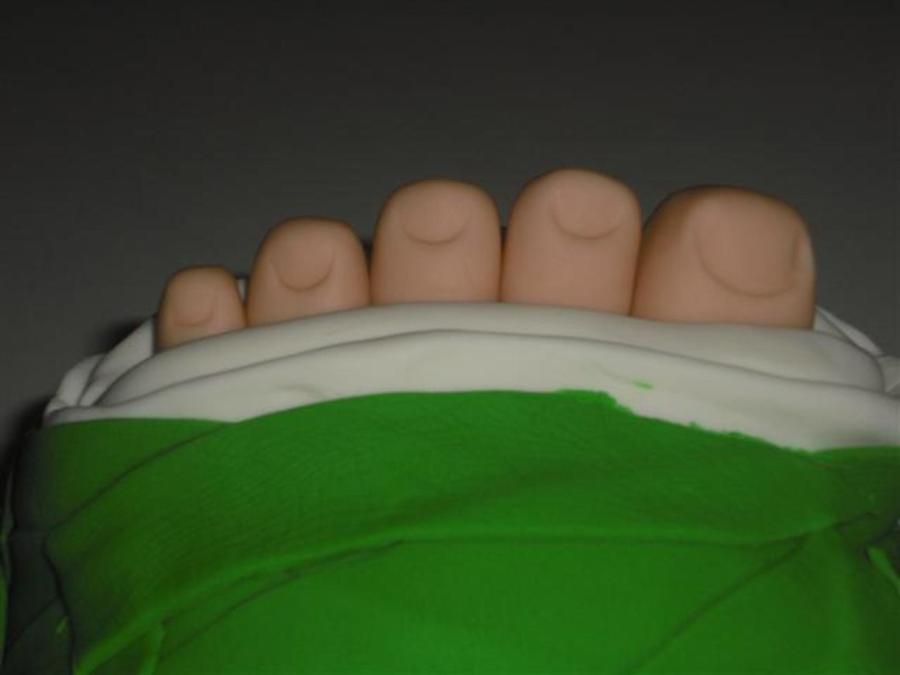 Broken Leg Cast Cake - CakeCentral.com