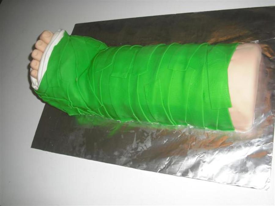Broken Leg Cast Cake - CakeCentral.com