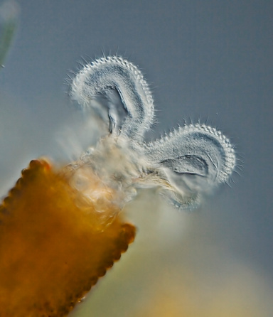 The Structure of Rotifers