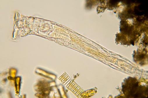 Organ Systems of Rotifers