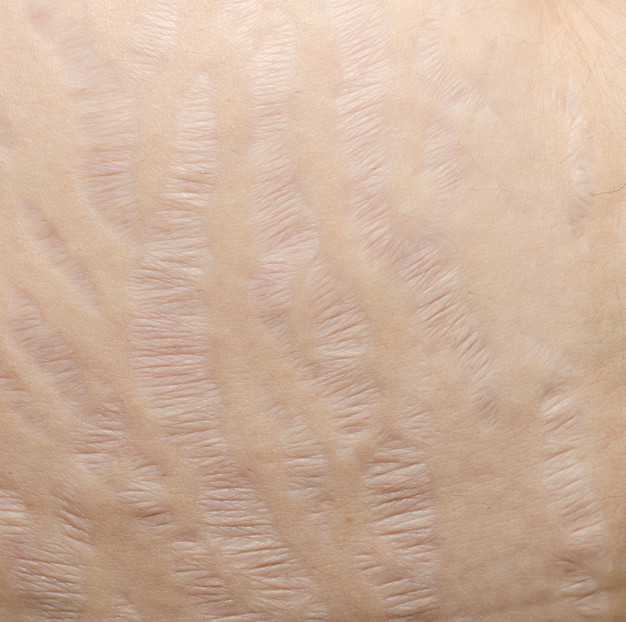 Just the Facts, Ma'am!