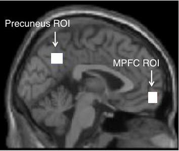 Photo | Medial prefrontal cortex | precuneus | UCLA