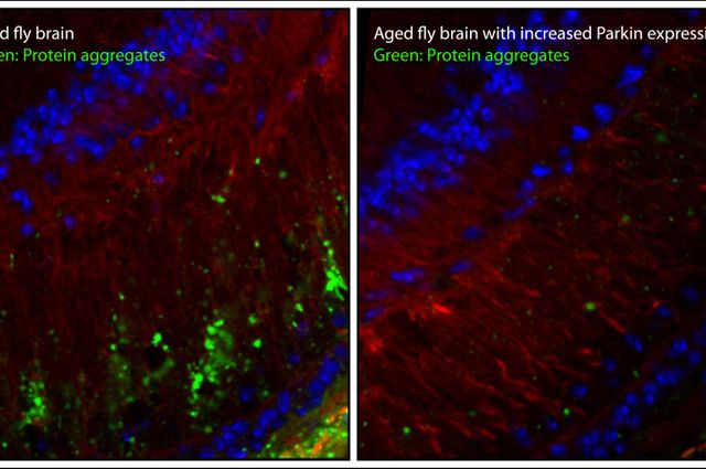 Boosting 'cellular garbage disposal' can delay the aging process, UCLA ...