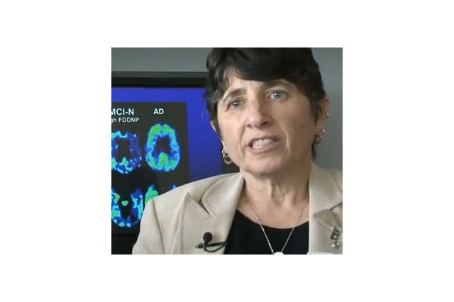 Heartache and hope: America’s Alzheimer’s epidemic | UCLA