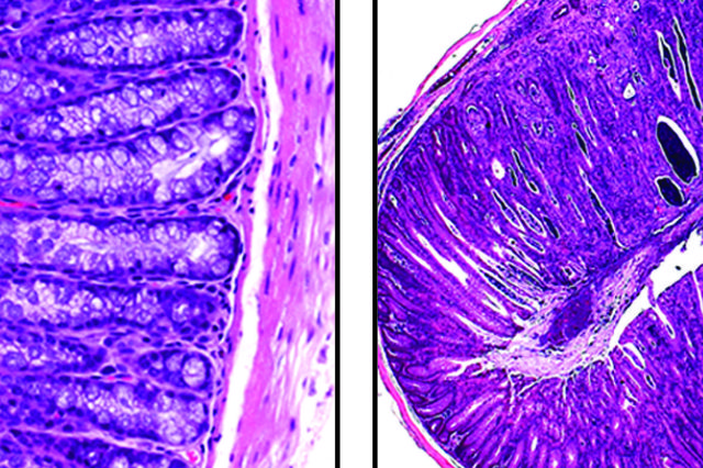 UCLA-led study identifies genetic factors involved in pediatric ...