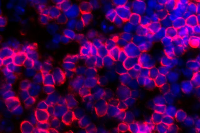 Artificial thymus developed at UCLA can produce cancer-fighting T cells ...