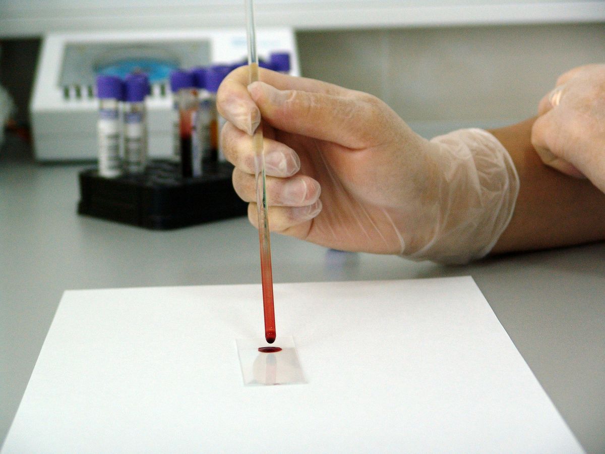 Photo | Laboratory blood test | UCLA