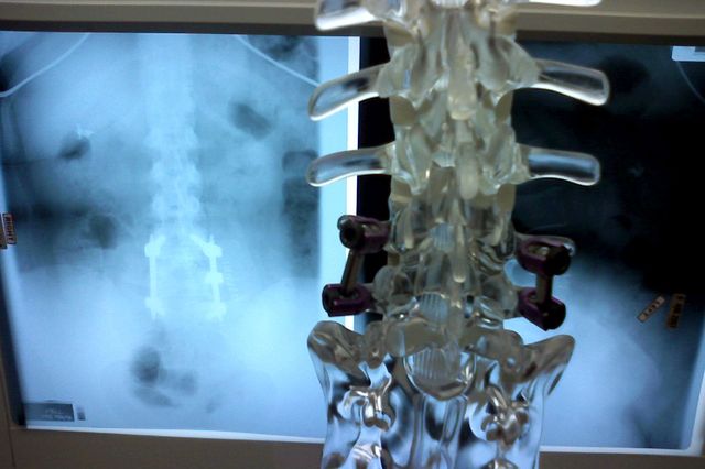 UCLA In the News January 3, 2018 | UCLA