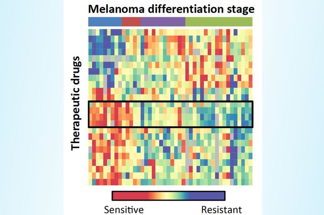 Discovery of 4 subtypes of melanoma points to new treatment approaches ...