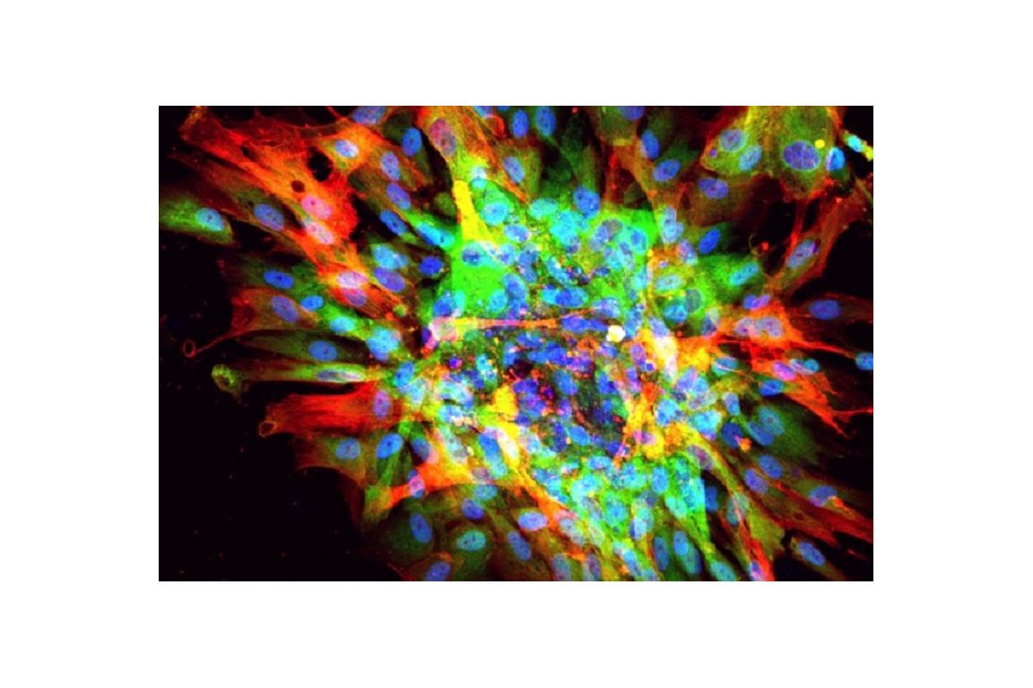 Researchers create accurate model of organ scarring using stem cells in ...