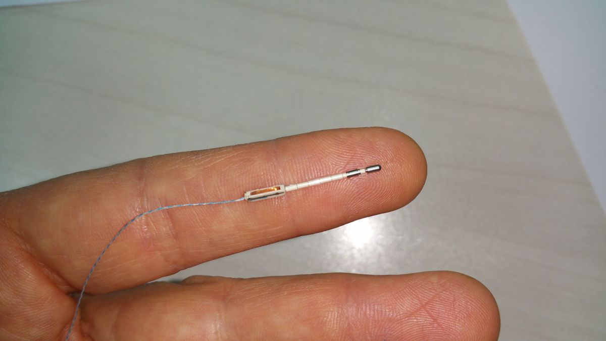 From UCLA Newsroom: “Nerve stimulation could provide new treatment ...