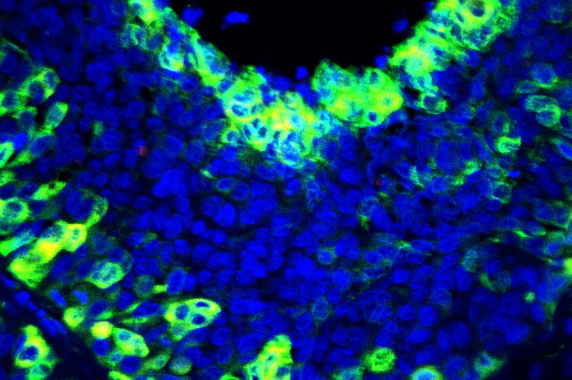 New alternate cell growth pathway could lead to better treatments for ...