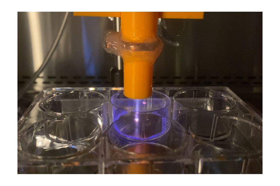 Photo | Cold plasma device | UCLA