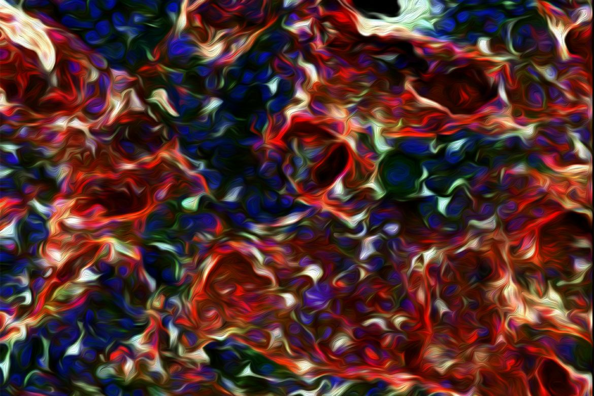 Photo | Endothelial cells | UCLA