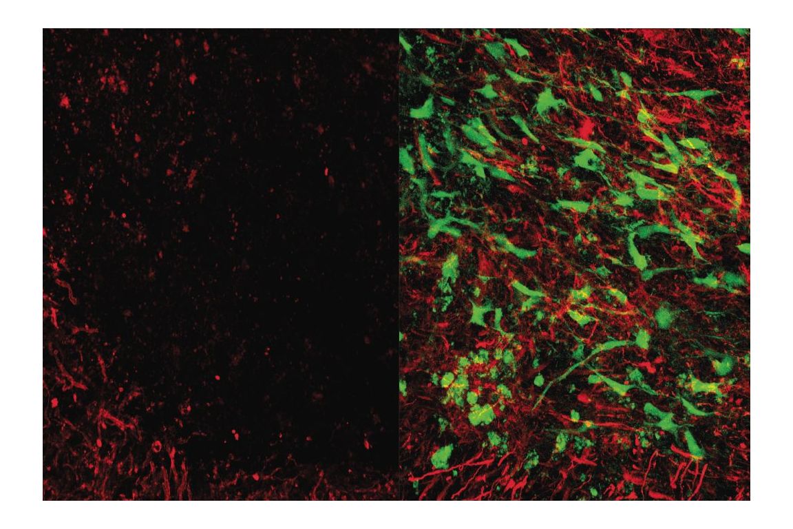 Stem cell therapy promotes recovery from stroke and dementia in mice | UCLA