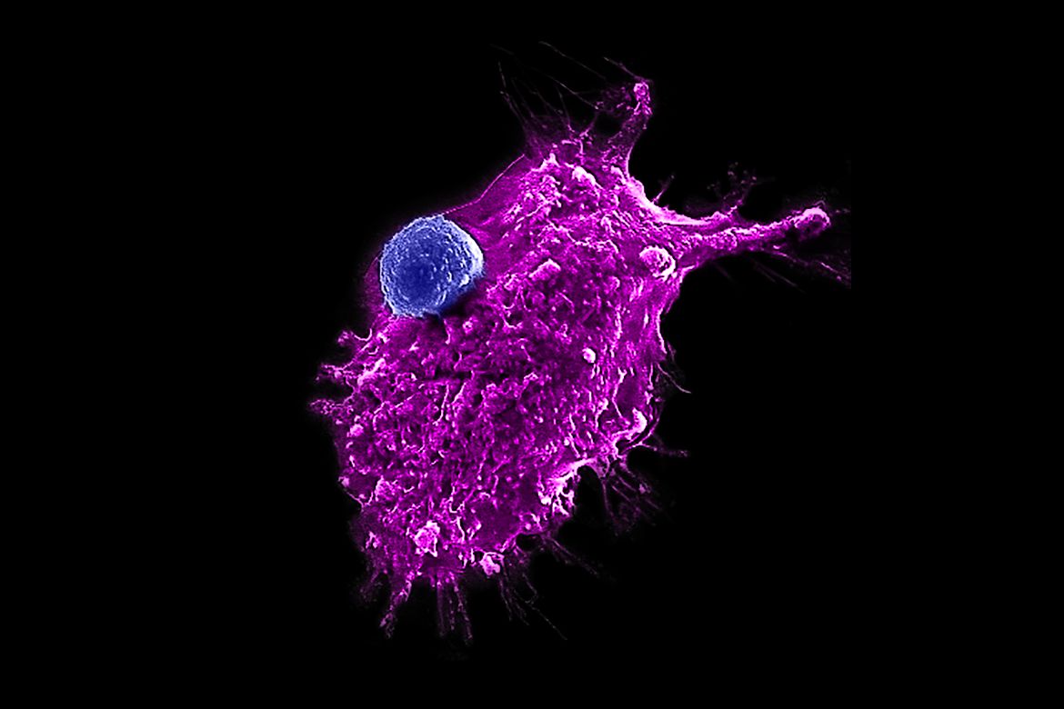 Photo | iNKT cell attacking a cancer cell | UCLA