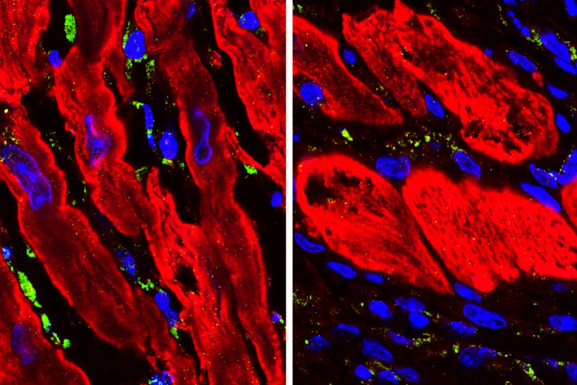Photo | Heart tissue in mice | UCLA