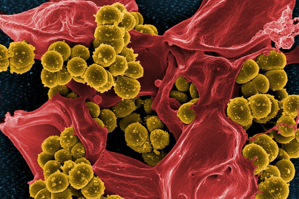 Study unravels antibiotic resistance in MRSA ‘superbug’ infections | UCLA